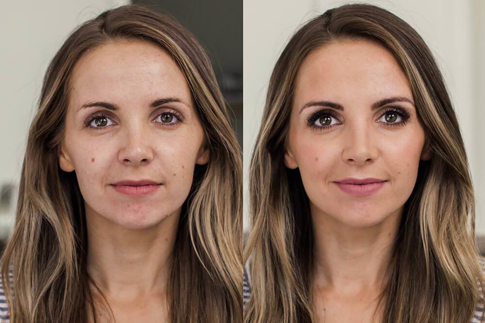 Merrick_Before_After - VoyagePhoenix - Phoenix